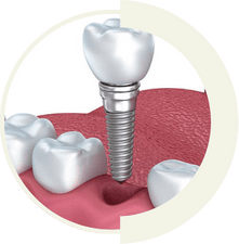 Dt. Kimiya Alizadeh | Master Of Dent Clinic